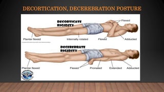 Nursing management of the client with increased intracranial pressure ...