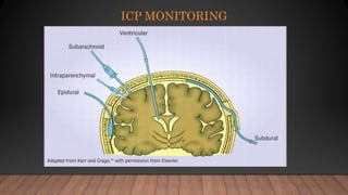 Nursing management of the client with increased intracranial pressure ...