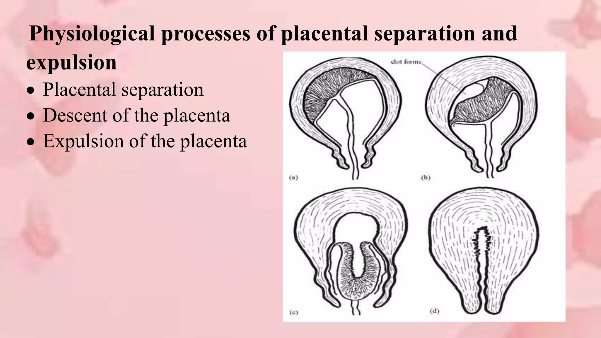 NURSING MANAGEMENT OF THIRD AND FOURTH STAGE OF LABOUR.docx.pptx