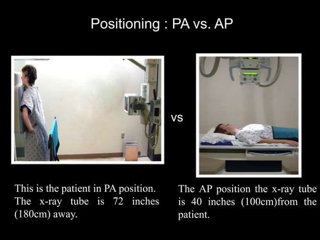 Interpretation of chest xray.For radiologist | PPT