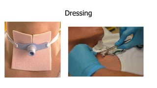 Nursing of tracheostomized patient.pptx