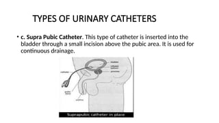 Clinical catherization,indications and complication | PPTX