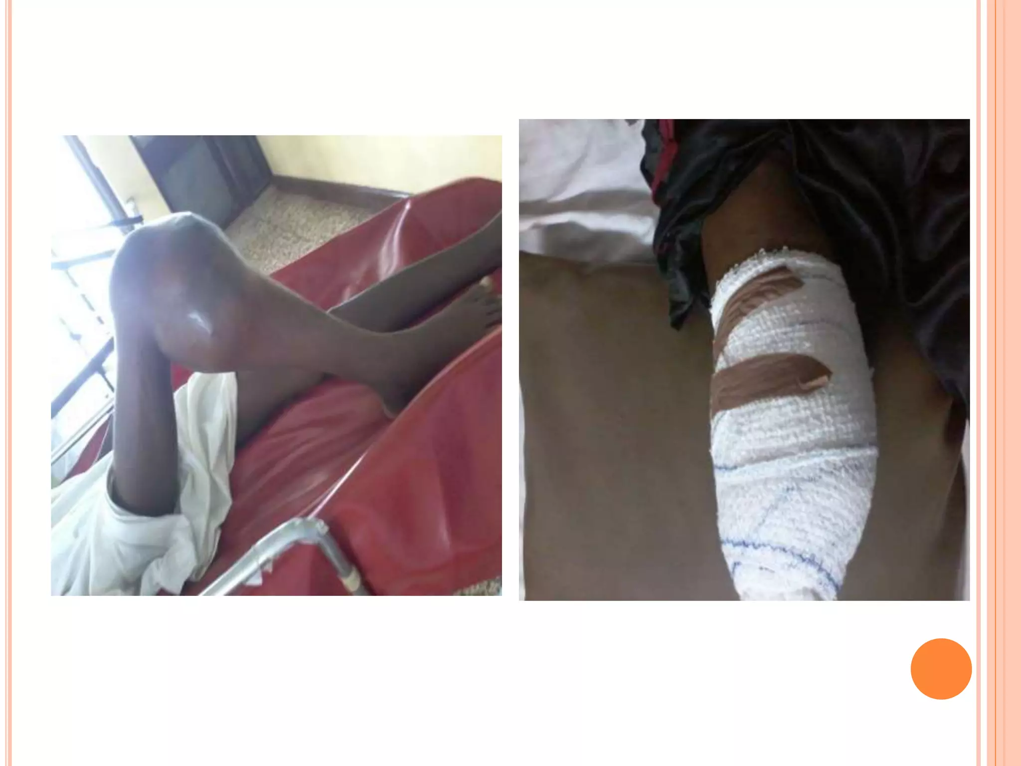 Nursing process, nanda i, nic & noc | PPTX