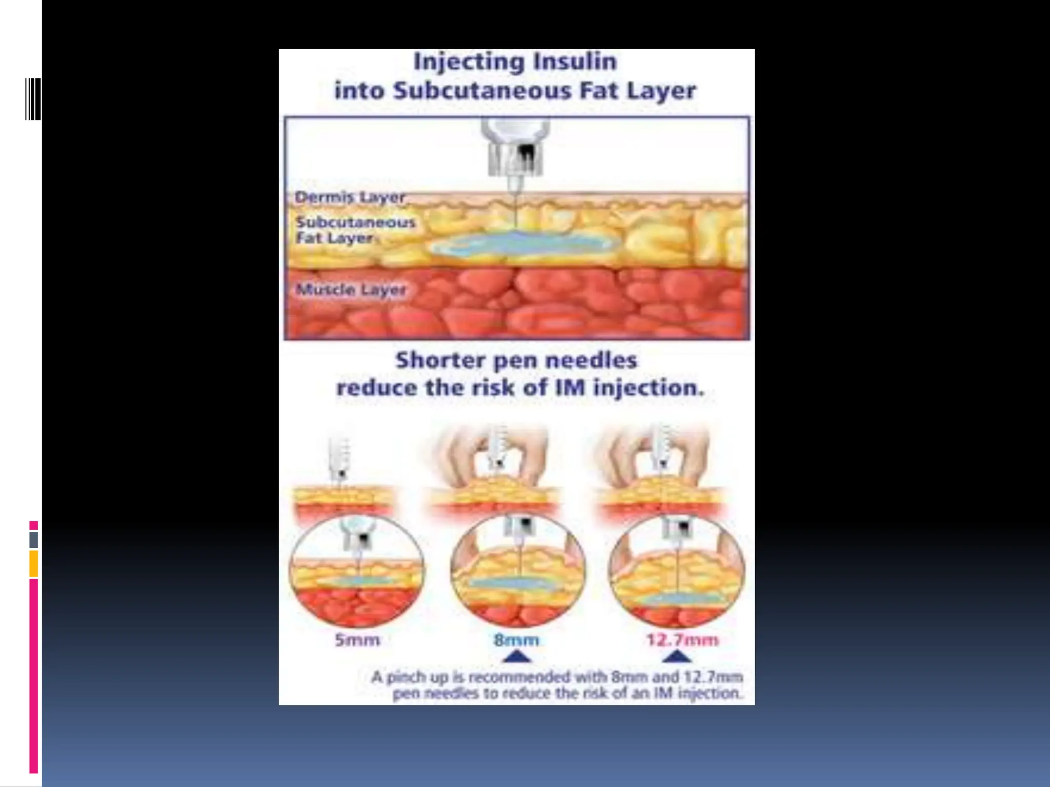 nursing skill injeksi insulin procedure.ppt