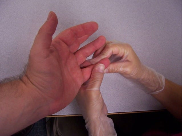 NursingWiki Fingerstick | PPT