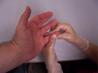 Nursingwiki Fingerstick | PPT | Diabetes | Diseases and Conditions