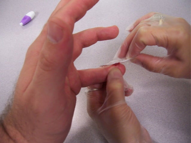 Nursingwiki Fingerstick | PPT | Diabetes | Diseases and Conditions