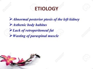 Nutcracker syndrome | PPTX