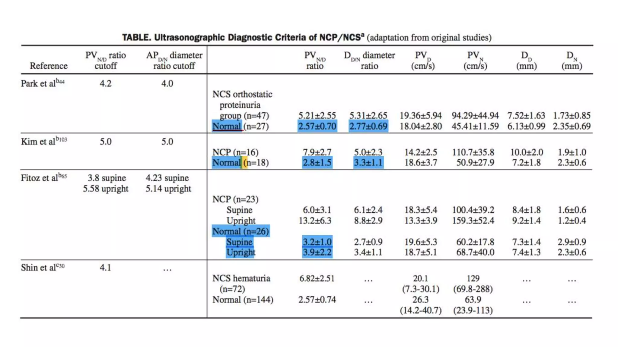 Nutcracker syndrome | PPTX
