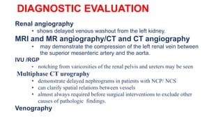 Nutcracker syndrome | PPTX