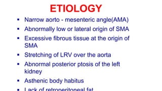 Nutcracker syndrome | PPTX