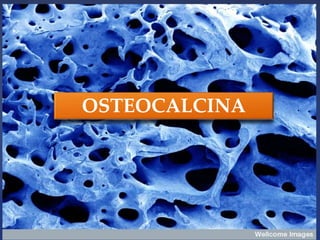 Nutricion osteocalcina