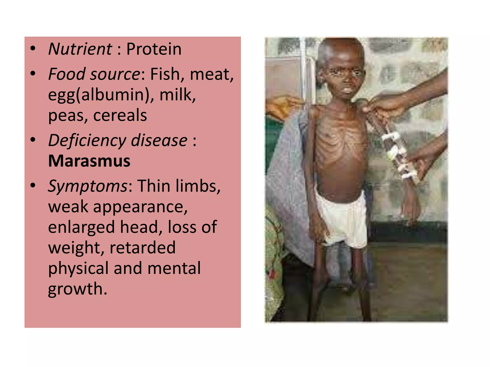 Nutrients & Deficiency disease | PPTX