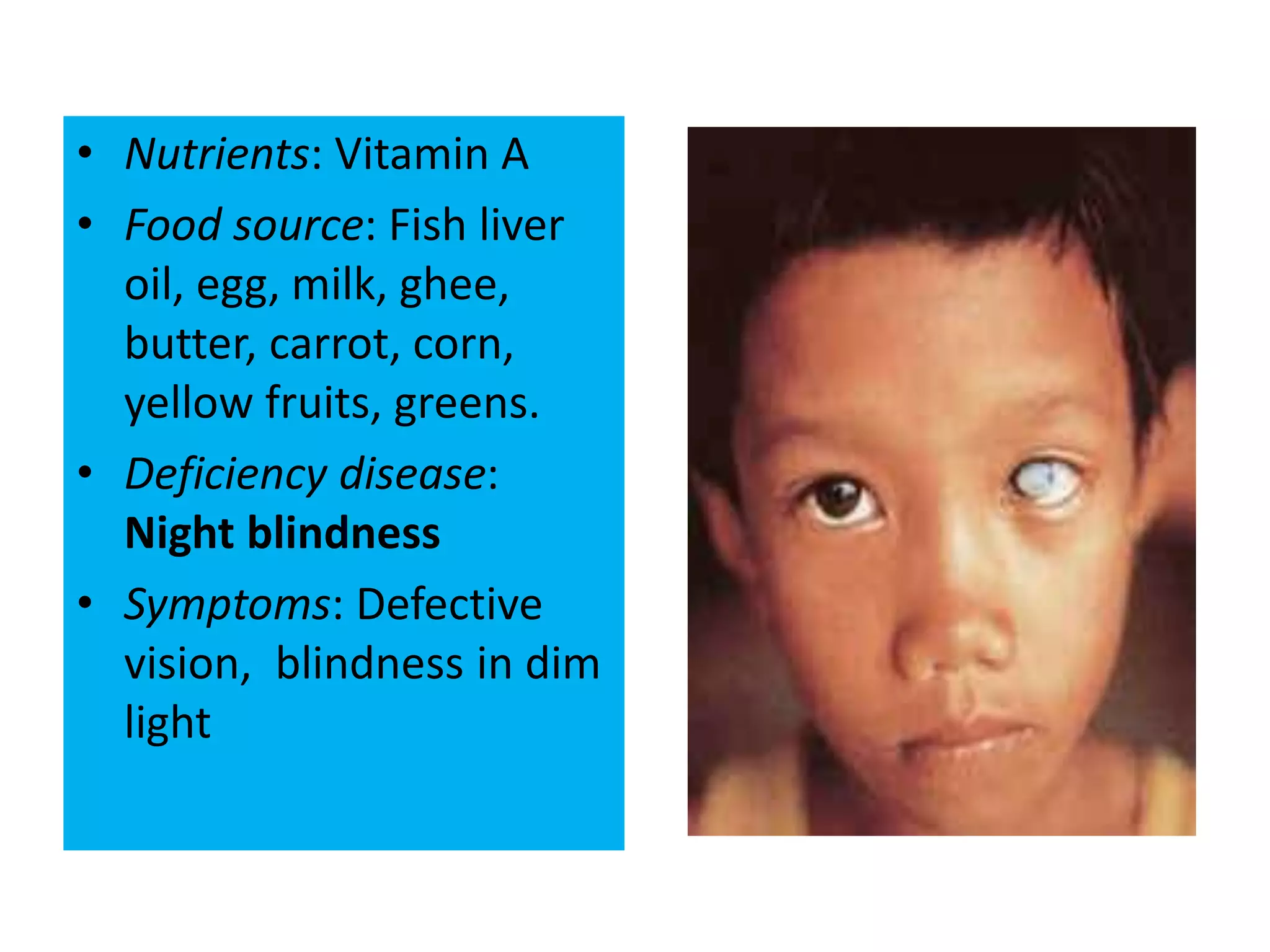 Nutrients & Deficiency disease | PPTX | Healthy Cooking and Eating ...