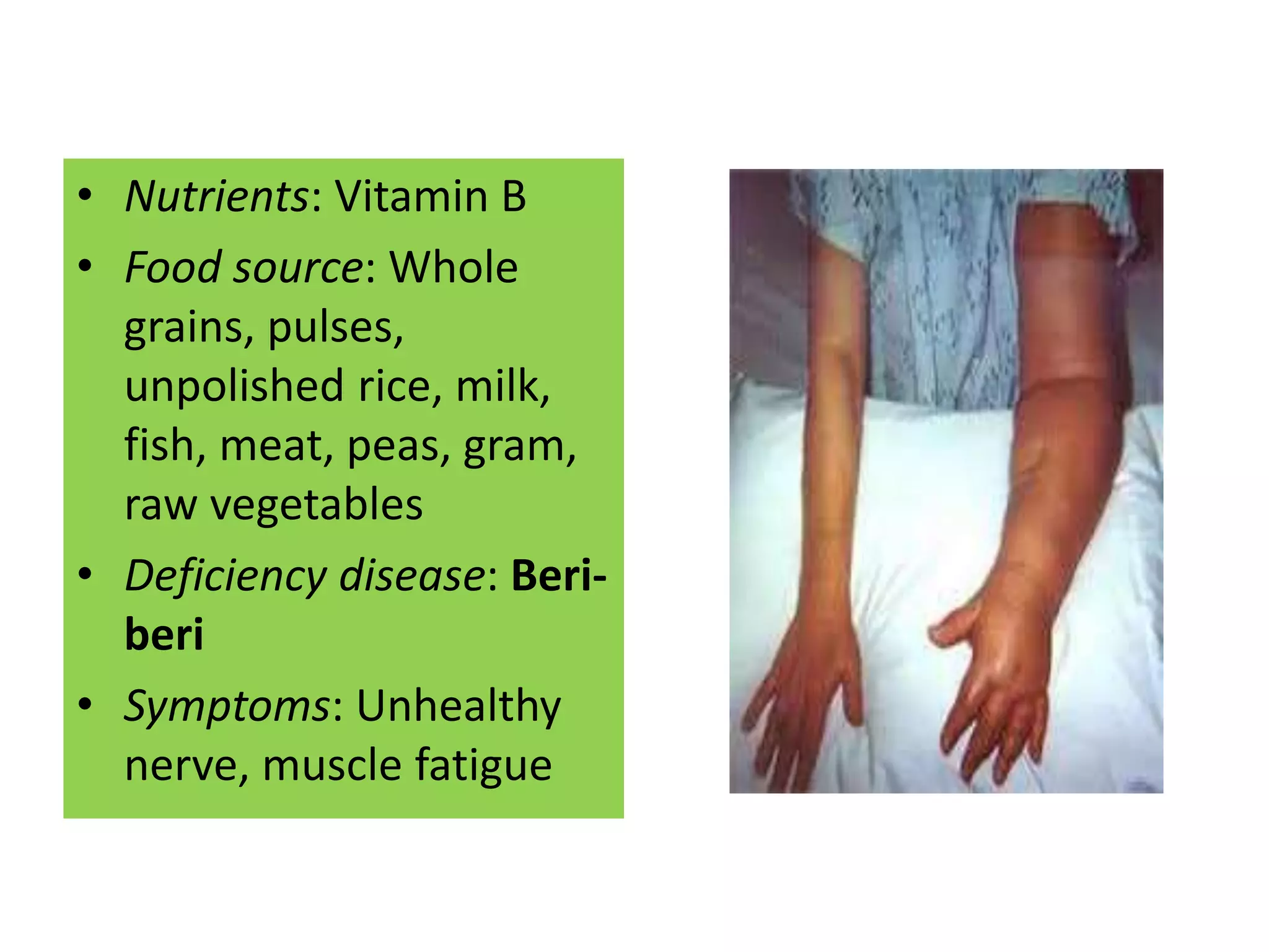 Nutrients & Deficiency disease | PPTX