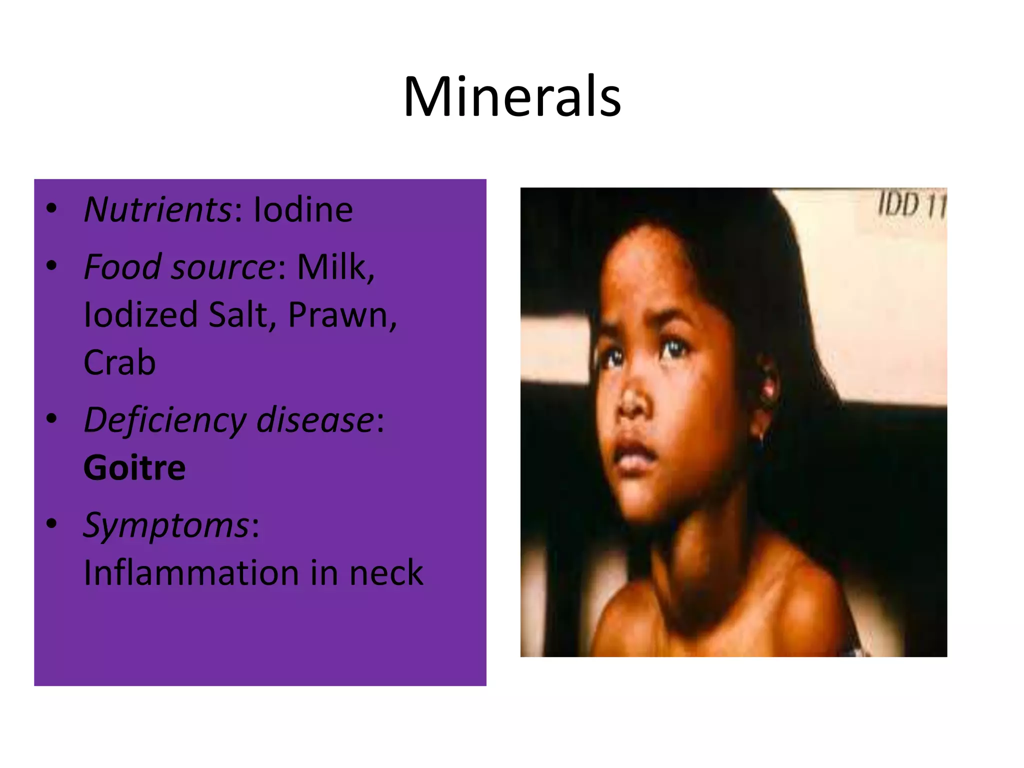 Nutrients & Deficiency disease | PPTX