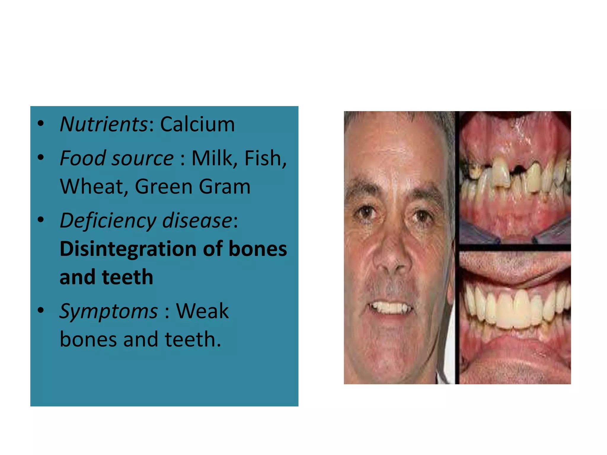 Nutrients & Deficiency disease | PPTX