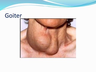 nutritional deficiency disorders in human | PPTX