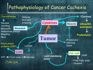 Nutrion support for cancer patients | PPTX