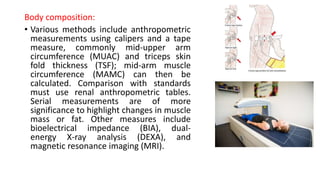 Nutrition of patients undergoing dialysis | PPTX