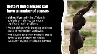 Nutrition.pdf on healthcare. how children need nutrition. | PPT