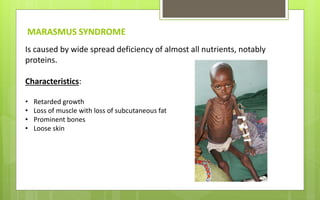 General physiology - Nutrition | PPTX