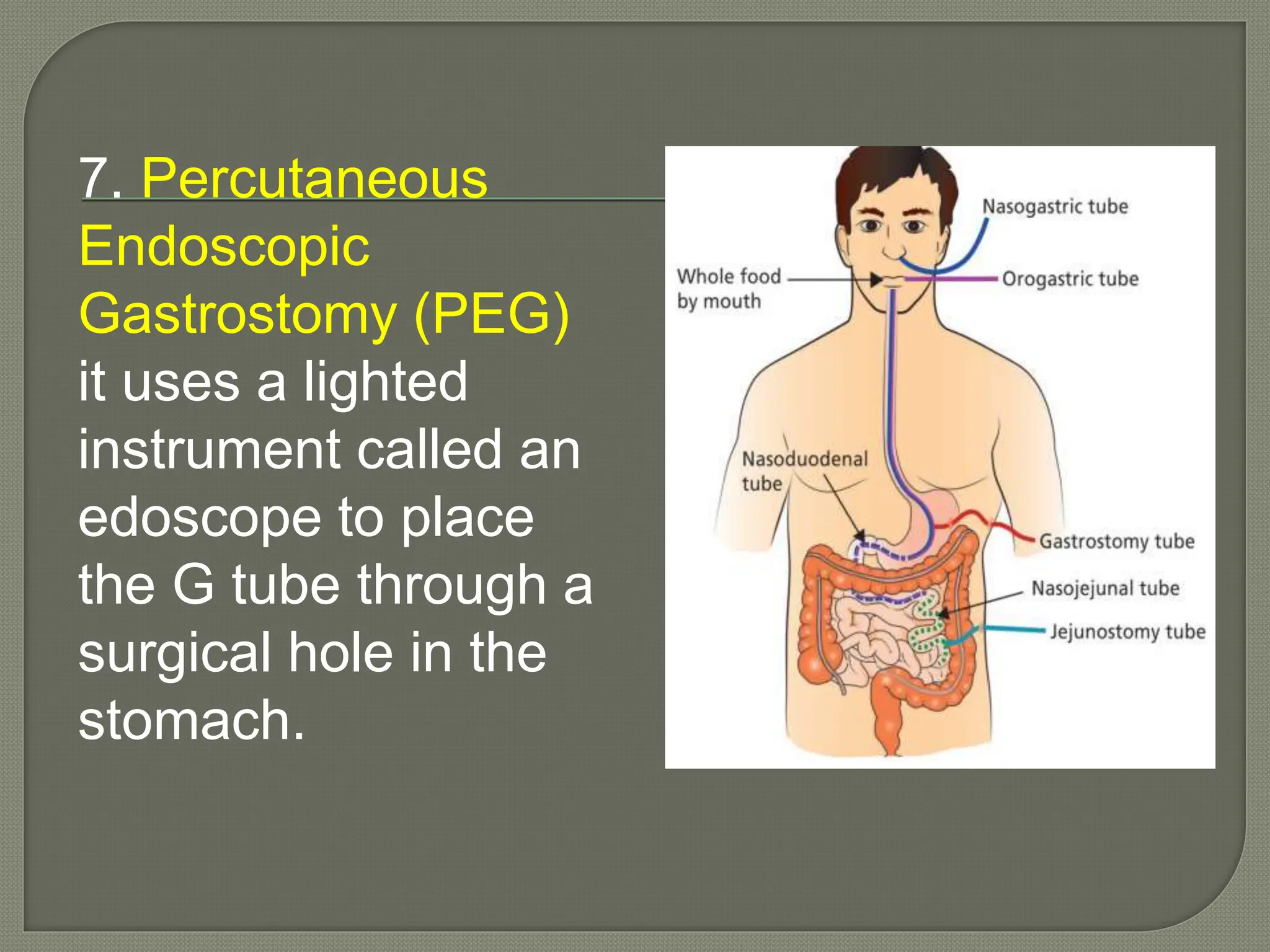 NUTRITION and diet therapy................ | PPTX