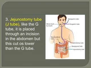 NUTRITION and diet therapy................ | PPTX