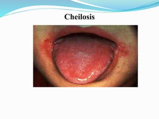 Diet and gastrointestinal problems | PPTX