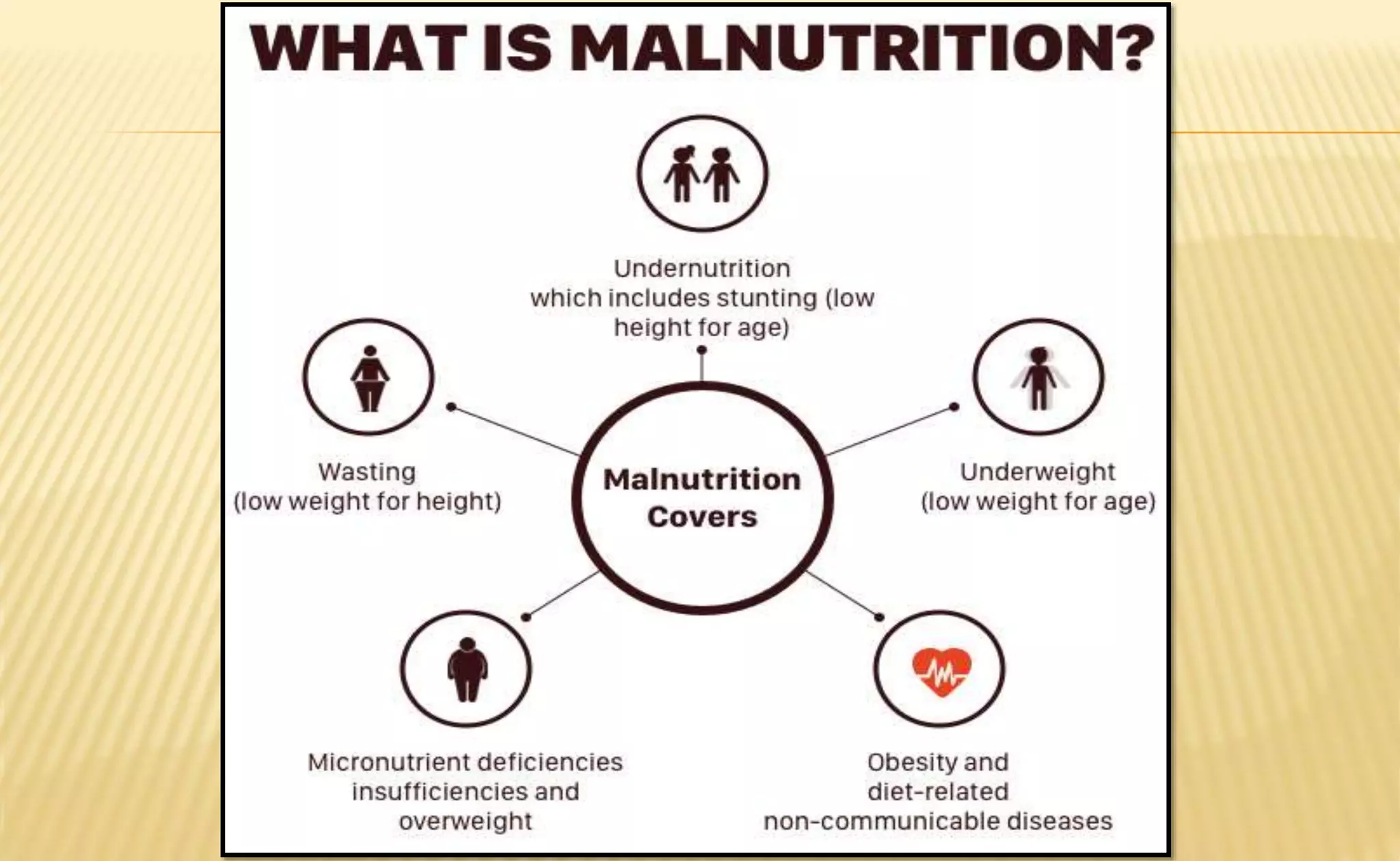 Malnutrition | PPT
