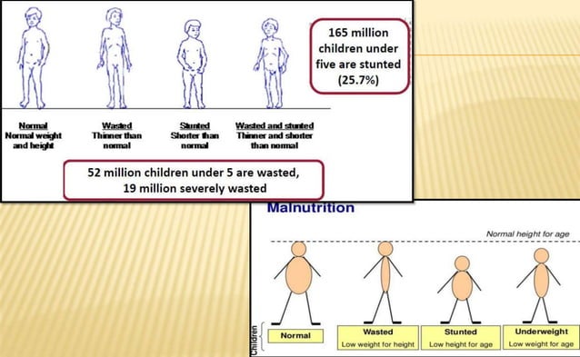 Malnutrition | PPT | Bone and Joint Conditions | Diseases and Conditions