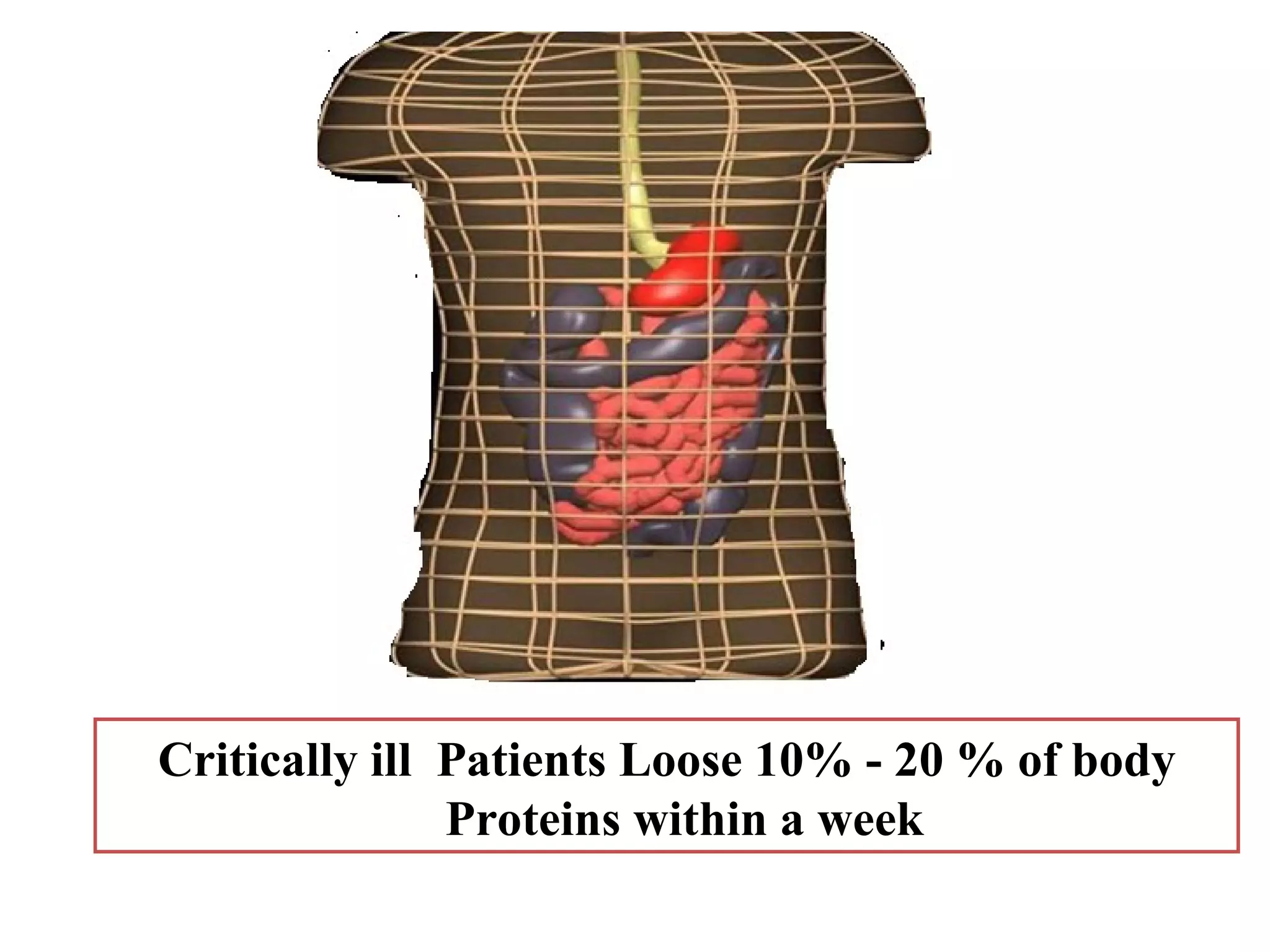 Nutritional Guidelines for ICU Patients | PPT