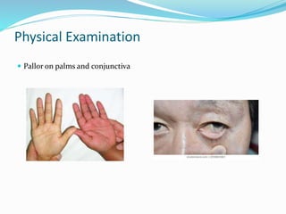 Nutritional anemia | PPTX