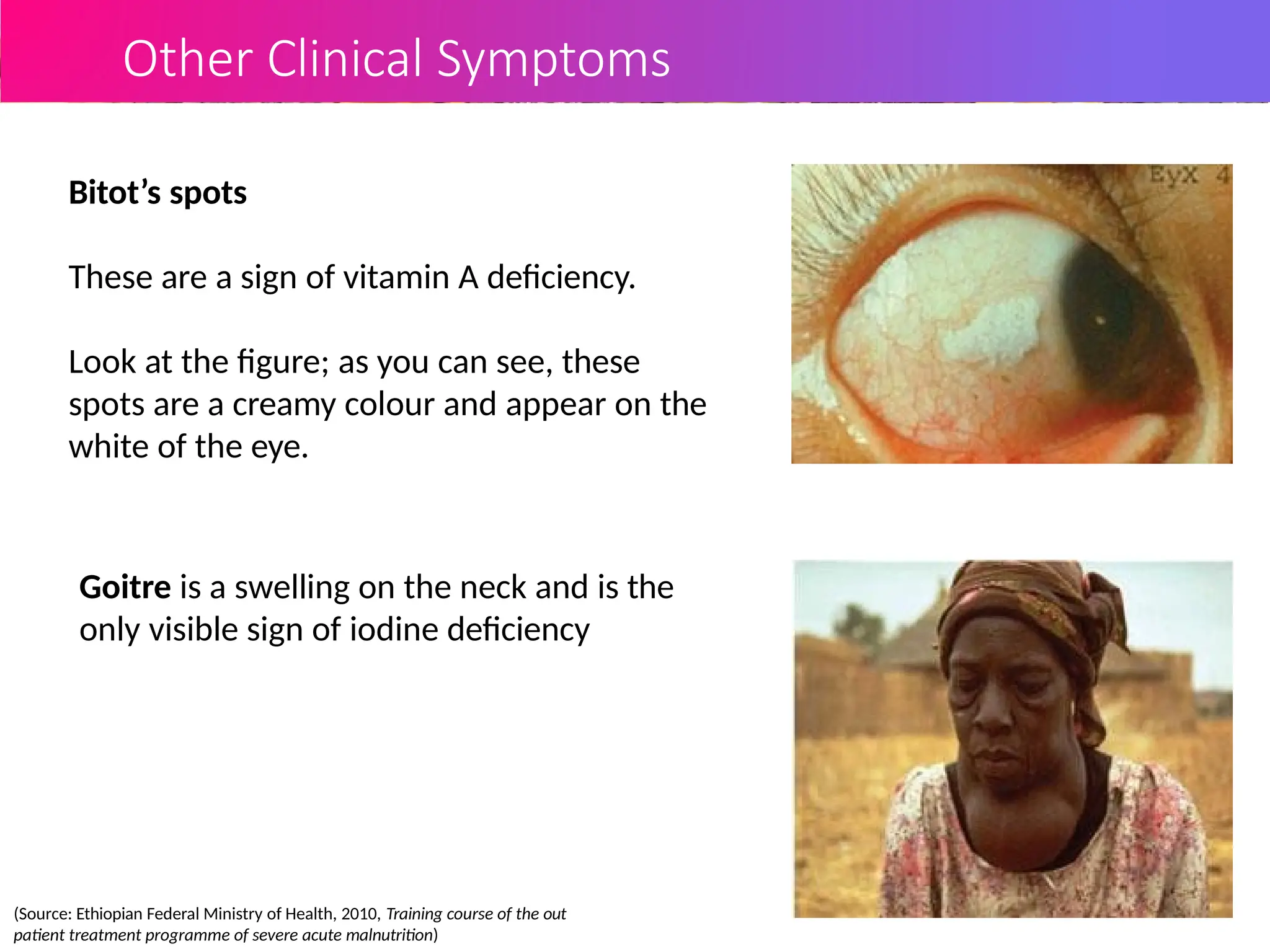 nutritionalassessment-1811111111101195206.pptx