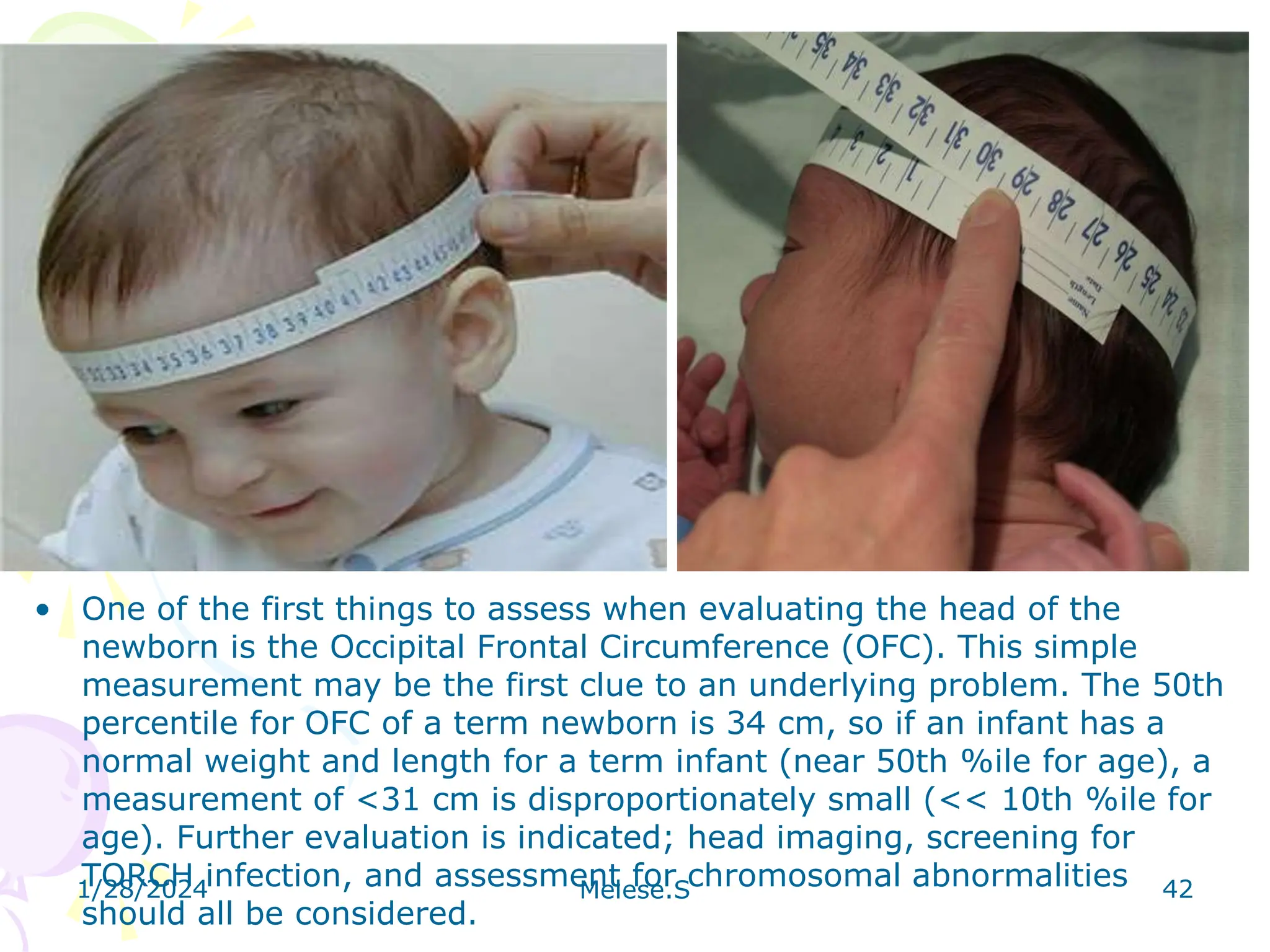 Nutritional Assessment lecture 2024.pptx