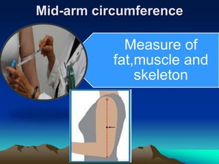 NUTRITIONAL ASSESSMENT .ppt