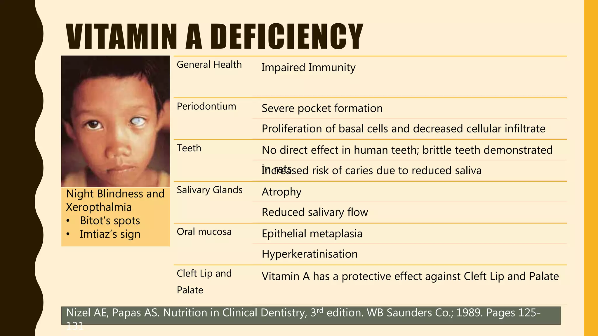 NUTRITIONAL DEFICENCYS IN CHILDREN.pdf