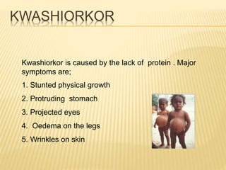 Nutritional deficiencies Power Point Presentation | PPTX