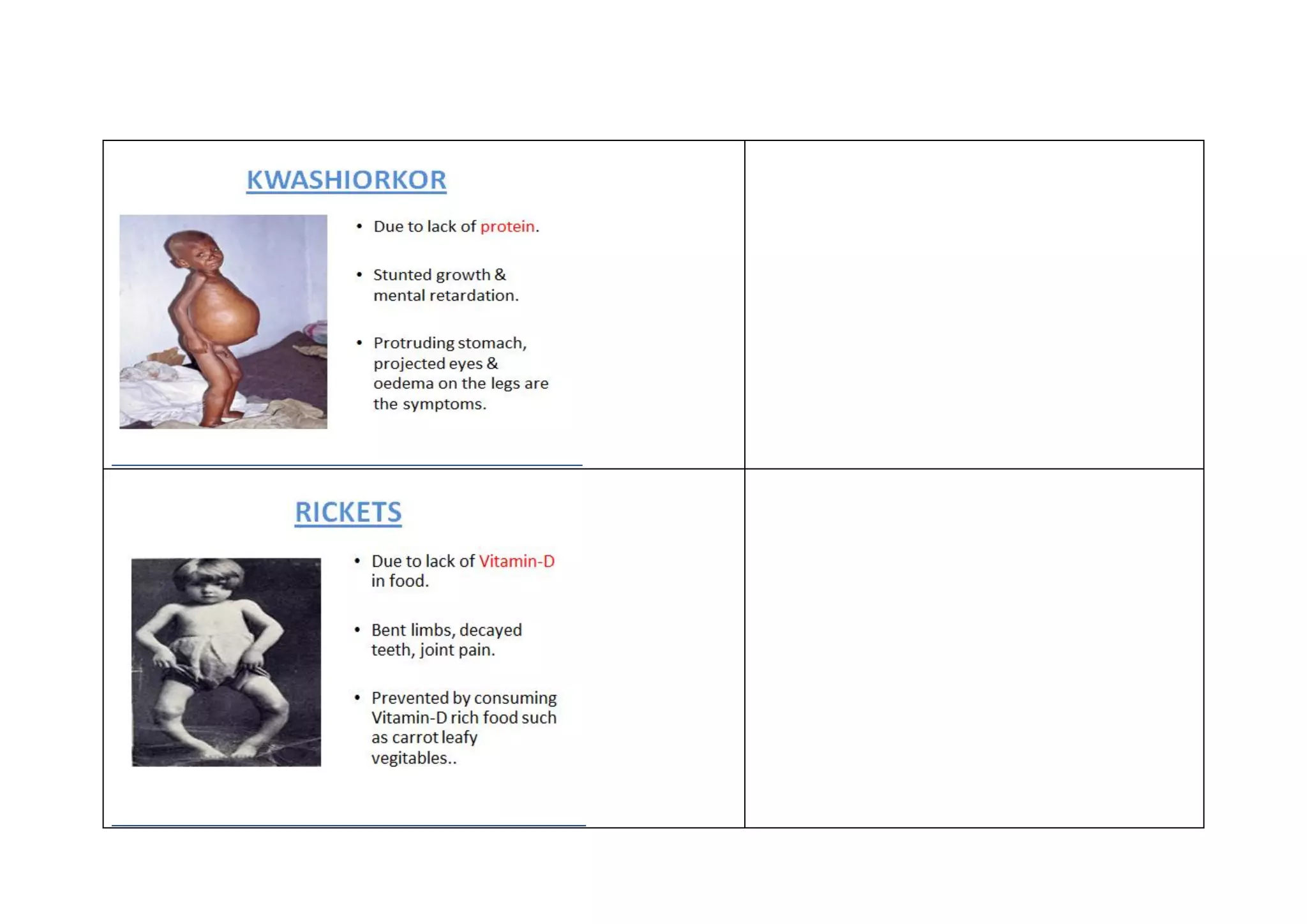 Nutritional Deficiency Diseases | PDF