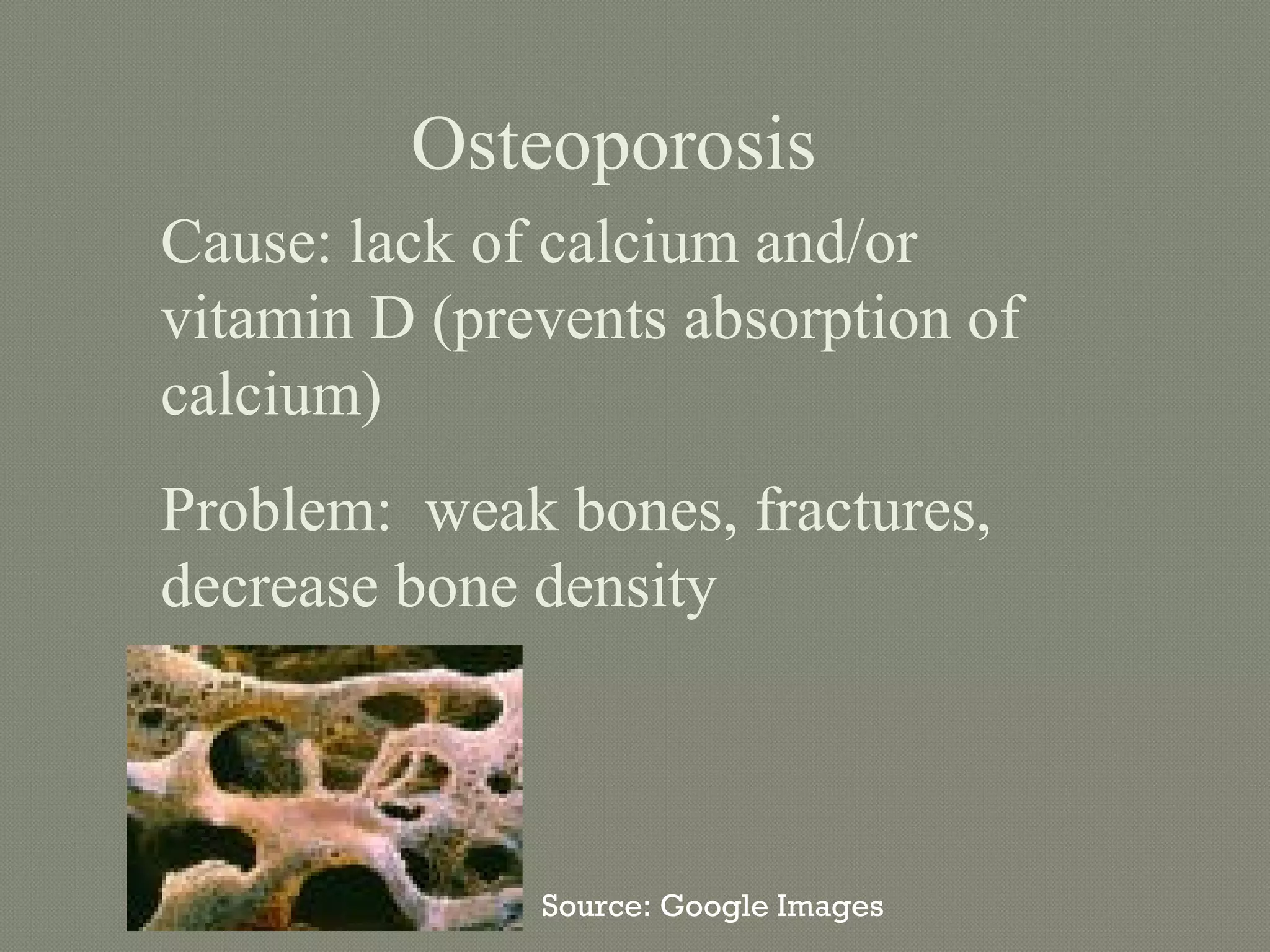 Nutritional Deficiency and Diseases, Prepared by: Edsyl Berongoy Penas, LPT | PPT | Diseases and ...