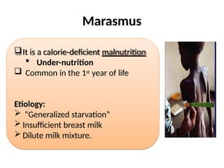 nutritional deficiency diseases.pptx.... | PPT
