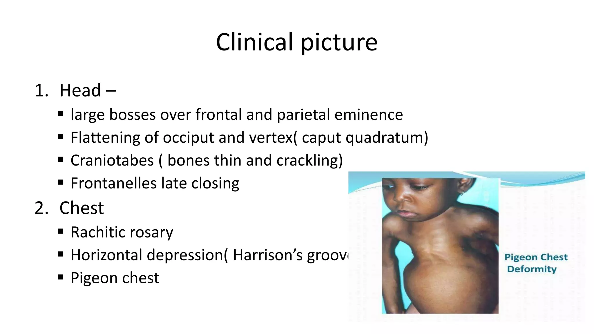 Nutritional deficiency diseases and its effect on bone copy | PPTX
