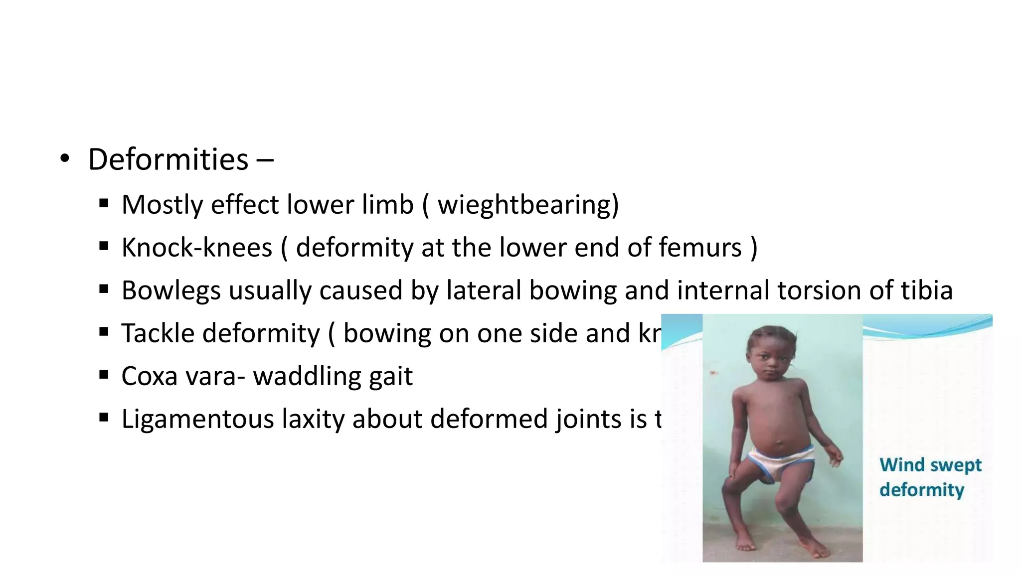 Nutritional deficiency diseases and its effect on bone copy | PPTX