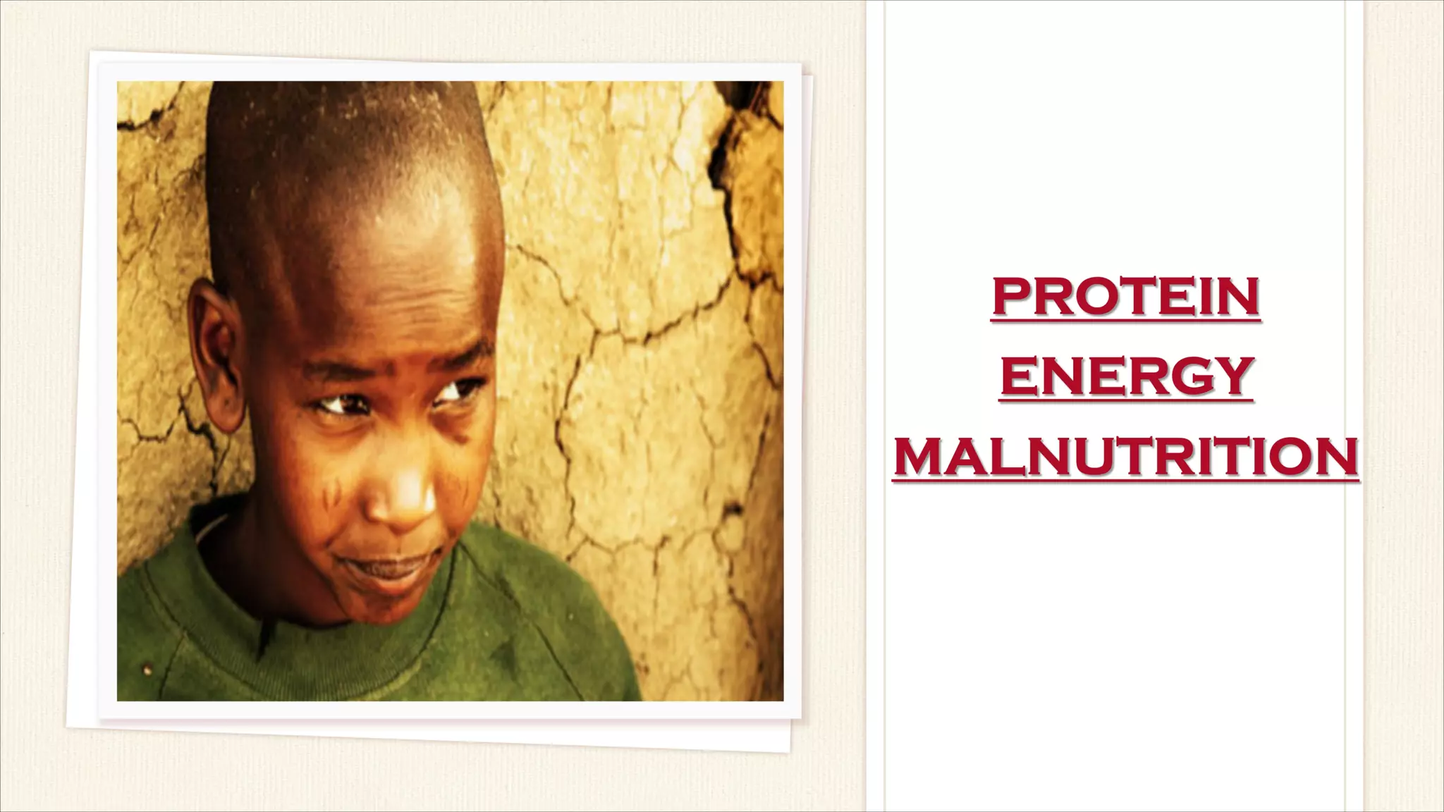 Nutritional deficiency disorder | PDF