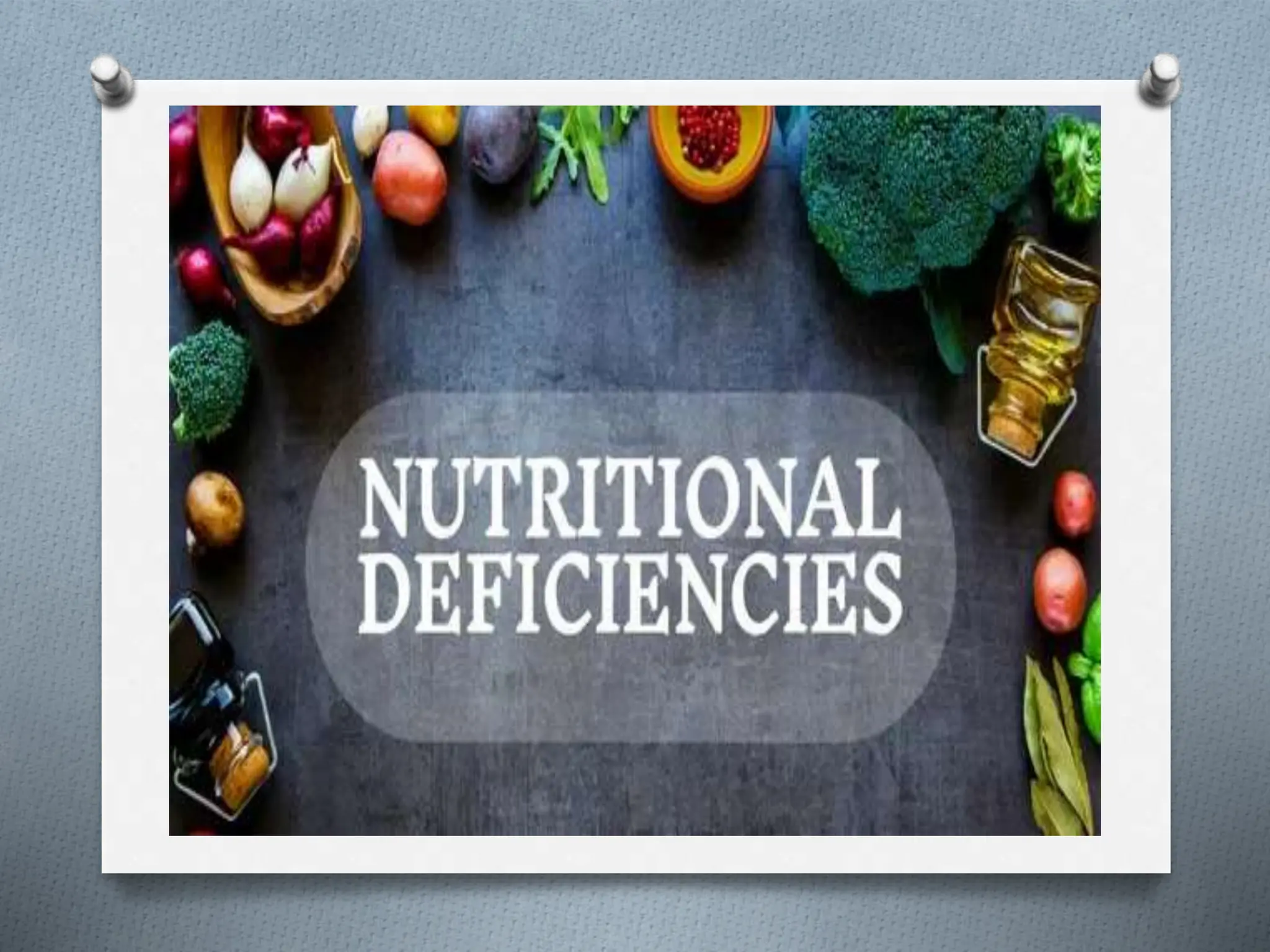 Nutritional deficiency disorder in Child | PPTX