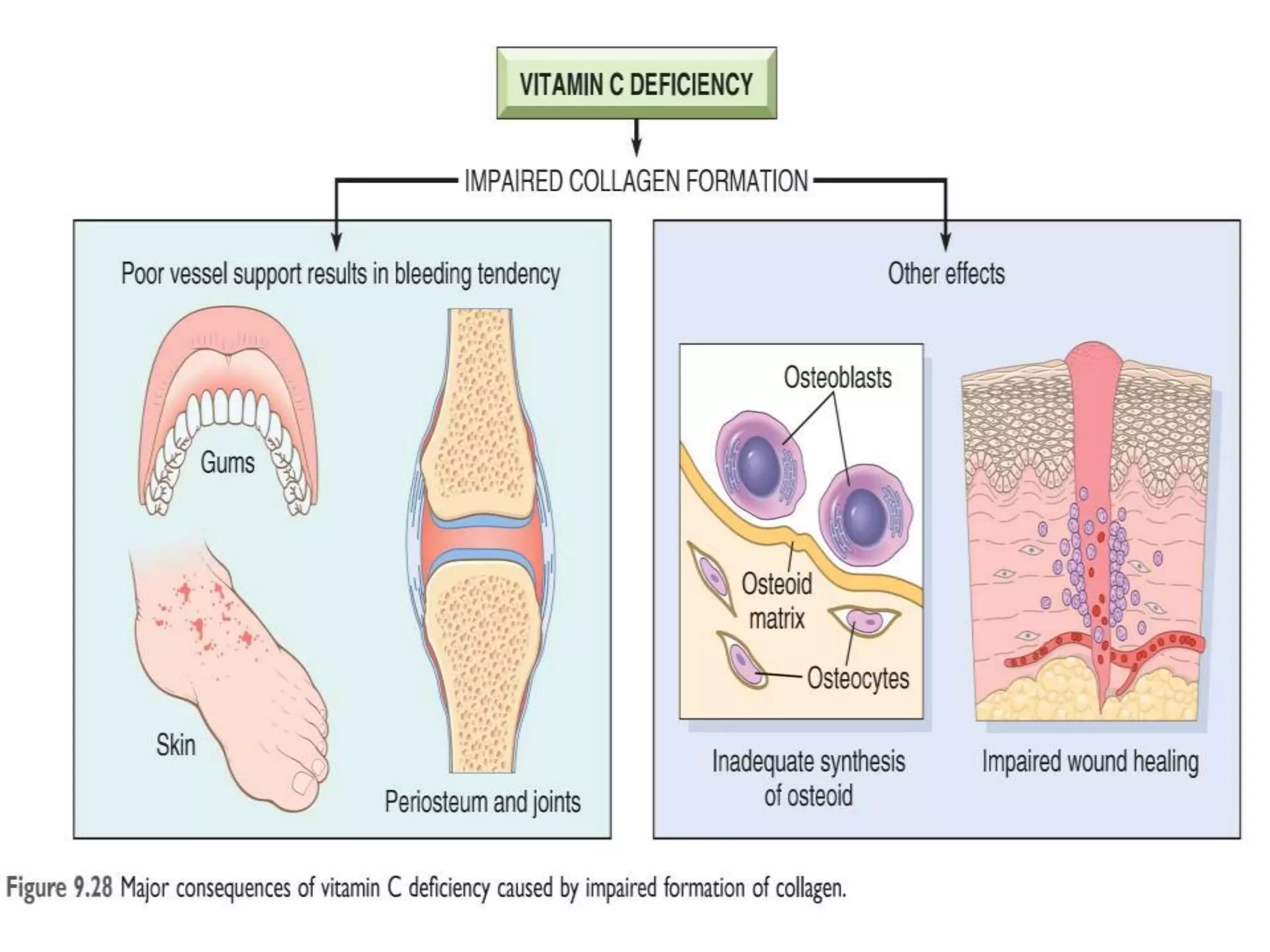 Nutritional diseases.pptx