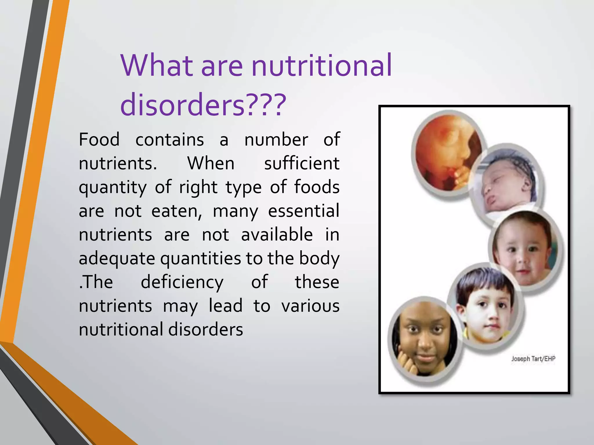Nutritional disorders | PPTX