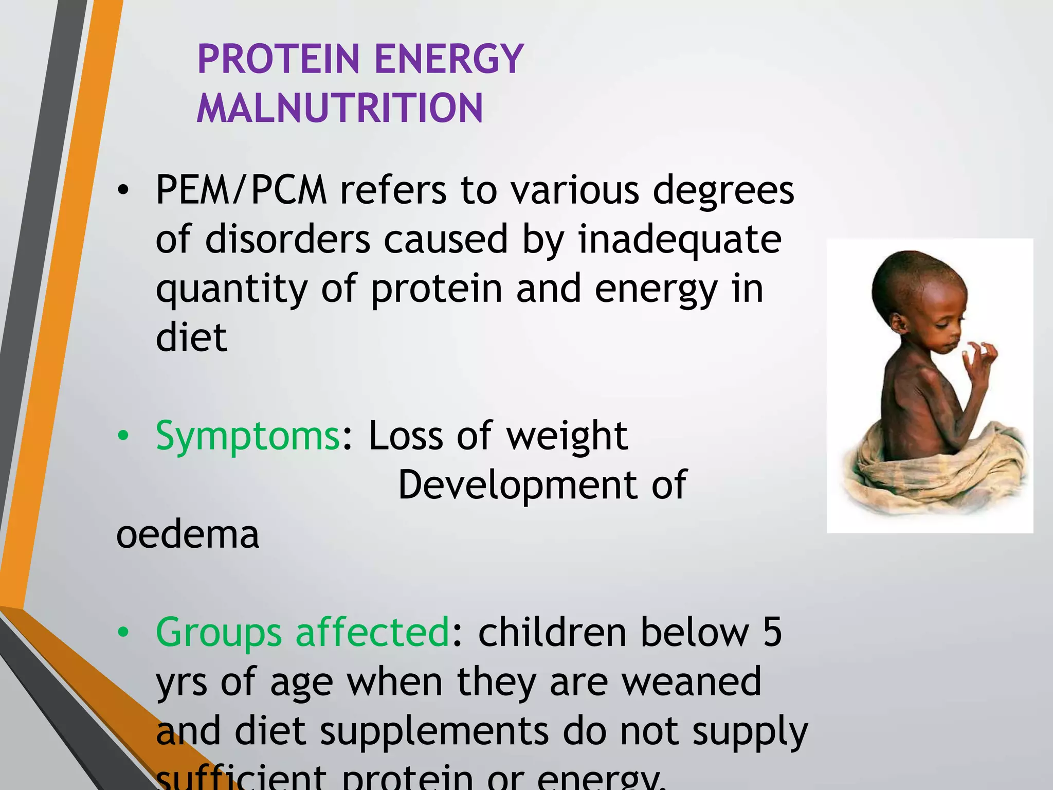 Nutritional disorders | PPTX