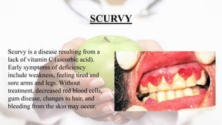 NUTRITIONAL DISORDERS AND PROTEIN ENERGY MALNUTRITION | PPTX