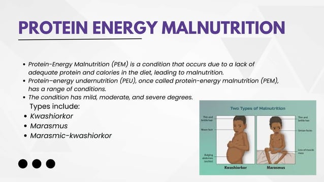 Nutritional disorders.Nutritional disorder and deficiencybtypesvof ...